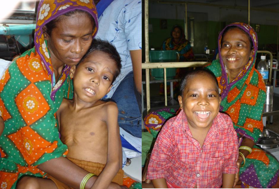 Bantra St. Thomas' Home Welfare Society | Tuberculosis Treatment Before ...